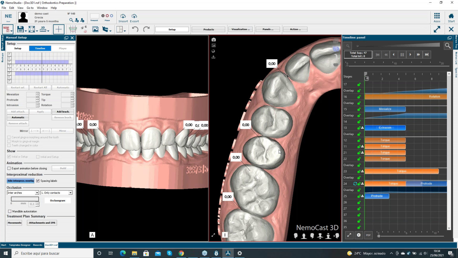 Nemotec software suite - Biotech Dental