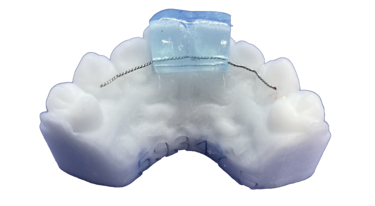 Retainers - Biotech Dental