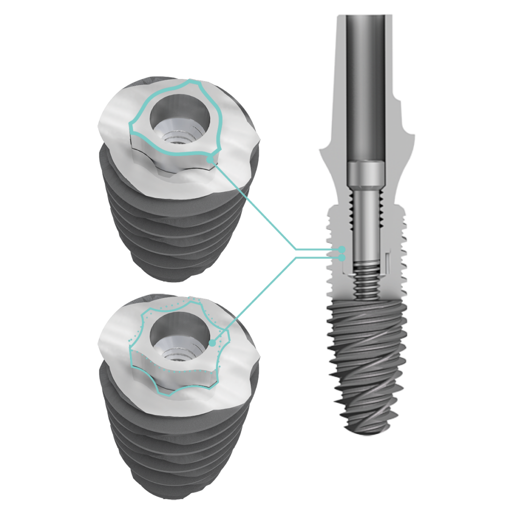 STSystem (EN) - Biotech Dental