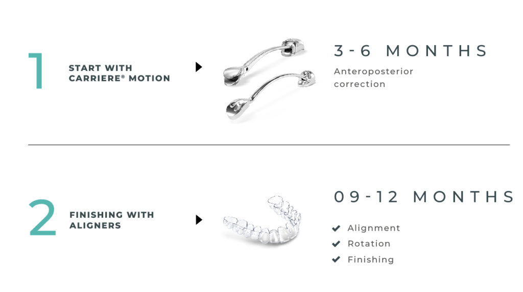 Carriere Motion - Biotech Dental